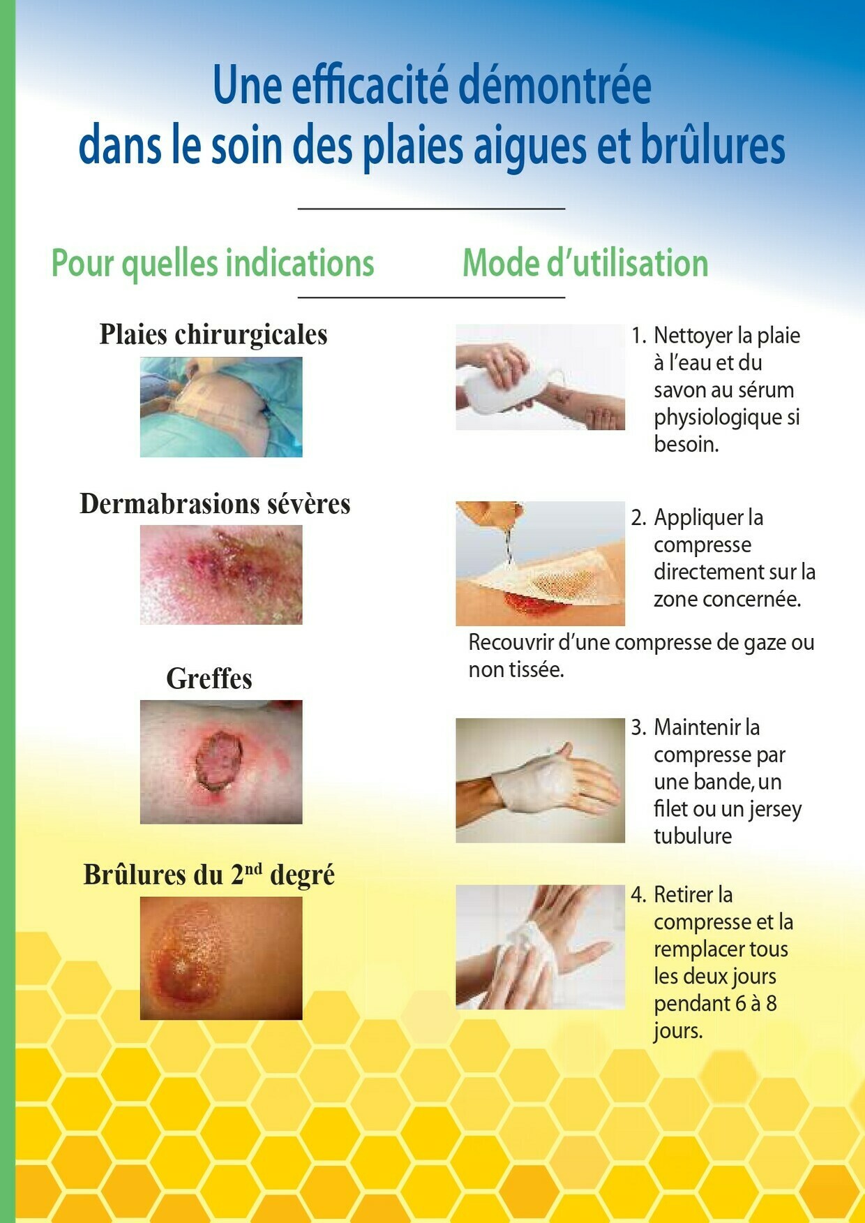 Plaies aigües - Brûlures : Tulle au miel médical Pour une cicatrisation ...